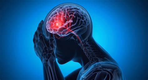 The Effectiveness Of Tnk As A Treatment For Strokes Covenant Health