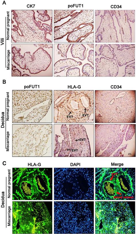 Role Of Pofut1 And O Fucosylation In Placental Angiogenesis†