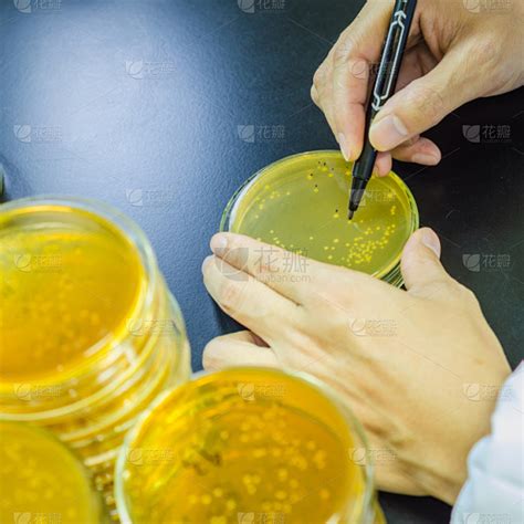 皮氏培养皿微生物盘子充满的分枝杆菌结核杆菌嗜肺性军团病杆菌无人有毒生物体科学