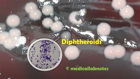 Diphtheria Bacillus And Diphtheroids Introduction Differences