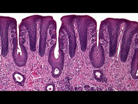 Circumvallate Papillae Practical Histology Youtube