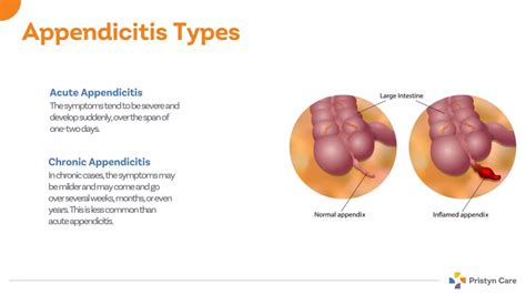 Appendicitis Causes Symptoms Treatment PPT