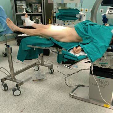 Hip X Ray Taken With Leg In A External Rotation B Internal Download Scientific Diagram