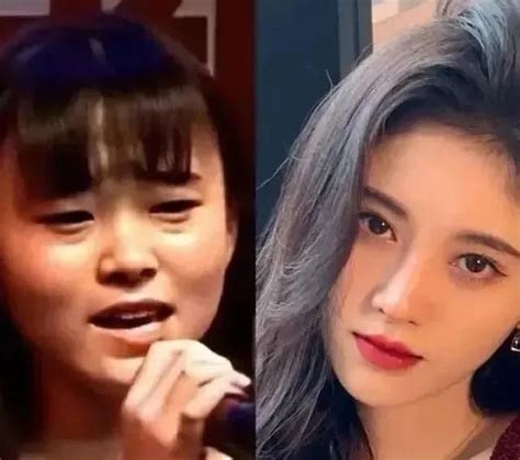 下巴脸颊凹陷鼻子透光明星整容后遗症明显还说是长开了
