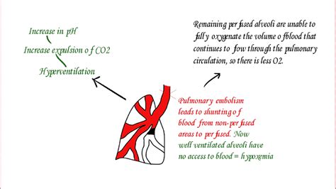 Ventilation Perfusion Mismatch Simple Medicine