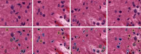 Evaluation Of Nucleus Segmentation In Digital Pathology Images Through Large Scale Image