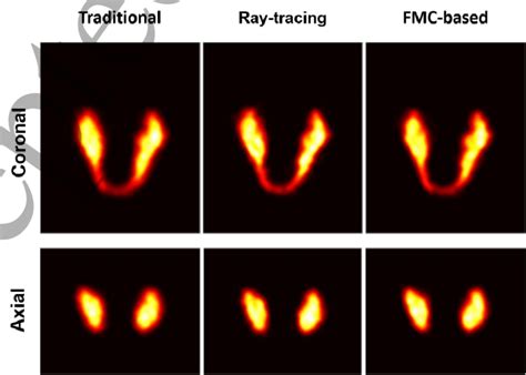 Experimental Mouse Thyroid Scan With 123 I To Compare The Fmc Based