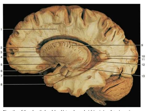 Diagram Of Hippocampal Formation Labelling Quizlet