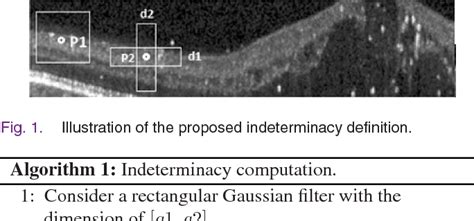 Figure 1 From Fully Automated Segmentation Of Fluidcyst Regions In Optical Coherence Tomography
