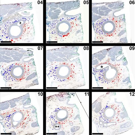 Retropancreatic Course Of The Superior Mesenteric Plexus Exemplary Download Scientific Diagram
