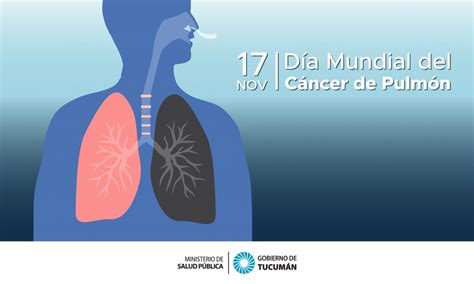 Día Internacional De La Lucha Contra El Cáncer De Pulmón Ministerio