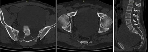 Surgical Neurology International