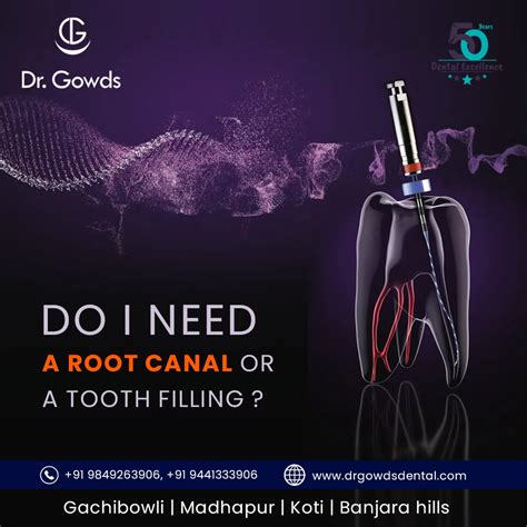 Root Canal Treatment Rct Dental Hospital In Hyderabad Best Dental