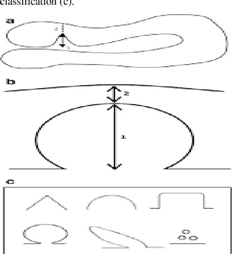 Figure 2 From Trans Vaginal Assessment Of Cesarean Scar Niche And Its
