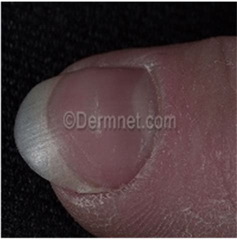 Confusion Matrix Showing Number Of Correctly Classified And