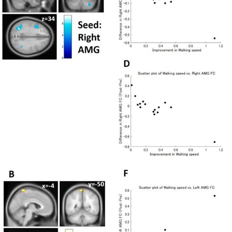 Functional Connectivity Fc Correlated With Walking Speed A Fc