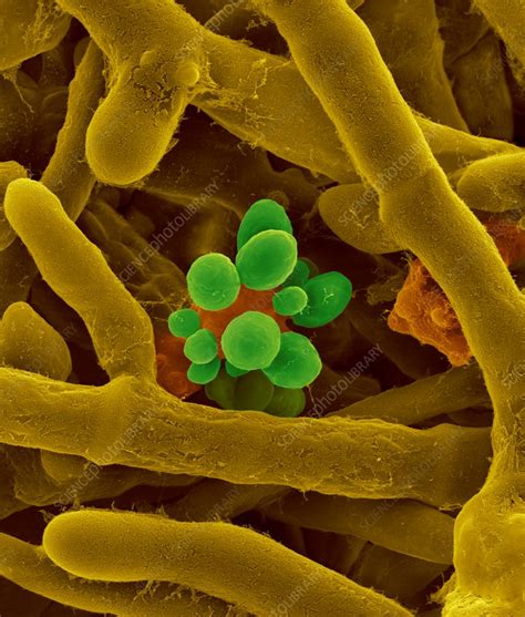 Allergenic Mould Aureobasidium Pullulans Sem Stock Image C032 3168
