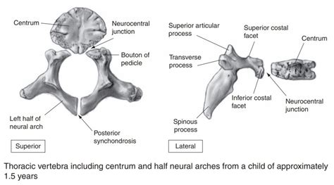 Human Vertebra Ossification Juvenile Osteology P99 Sauropod