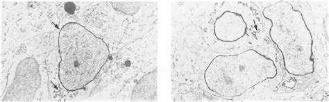 Figure 1 From Demonstration Of Glucose 6 Phosphatase And Peroxisomal