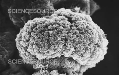 Human Polytene Chromosome Sem Stock Image Science Source Images