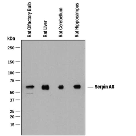 Rat Serpin A6 Antibody R D Systems 100μg Unlabeledantibodies
