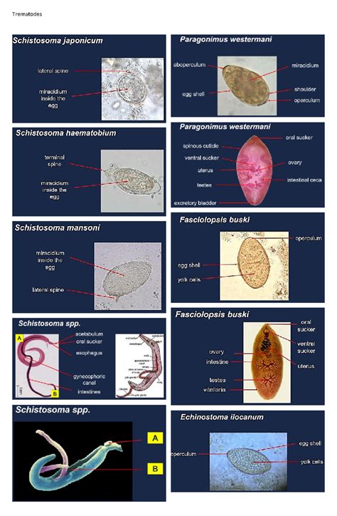 Trematodes Labeled Trematodes Labeled Practice For Practical Exam