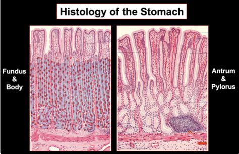 Fundus And Antrum Histology