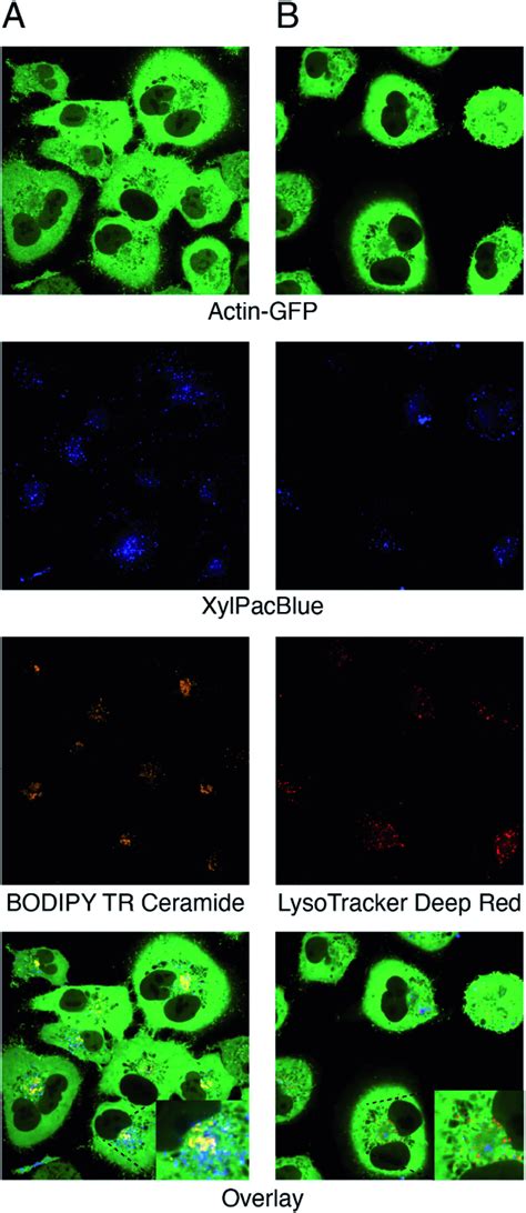 Confocal Microscopy Of Gfp Tagged Human A549 Epithelial Cells Treated
