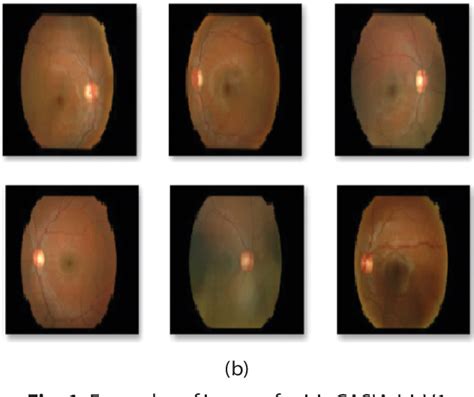 Figure 1 From Achieving Information Security By Multi Modal Iris Retina
