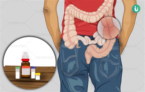 Homeopathic Treatment Medicines Remedies For Irritable Bowel Syndrome