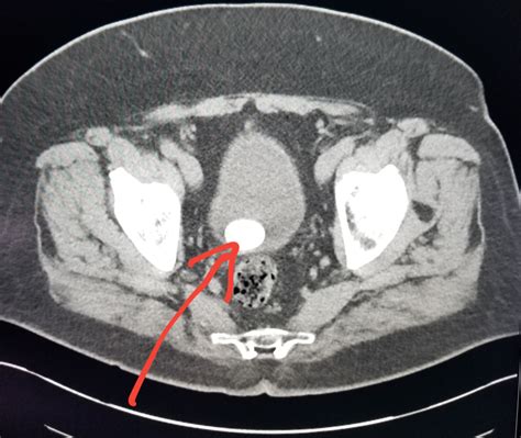What Does A Ct Scan Look Like