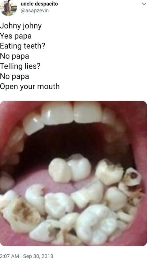 Uncle Despacito Johny Johny Yes Papa Eating Teeth No Papa Telling Lies