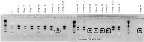 Semi Nested Pcr And Direct Sequencing On Dna Extracted From 16