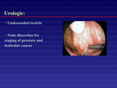 Programming Overload Pelvic Anatomy Laparoscopy Laparoscopic