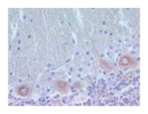 Pkc Mouse Unlabeled Clone 14 Bd 150μg Unlabeledantibodies