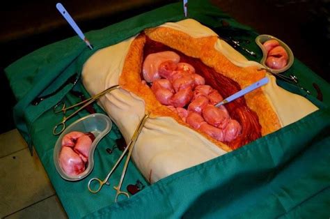 Surgery Cake Ratbge