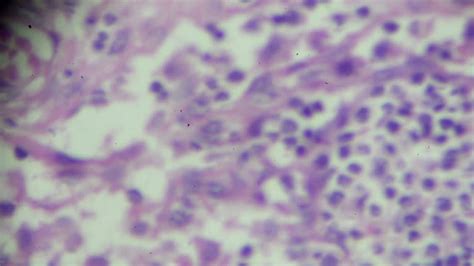 106 Human Body Under The Microscope Stock Videos Footage And 4k Video Clips Getty Images