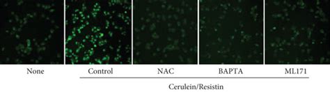 Nac Ml171 Or Bapta Am Inhibits Ceruleinresistin Induced Increases In
