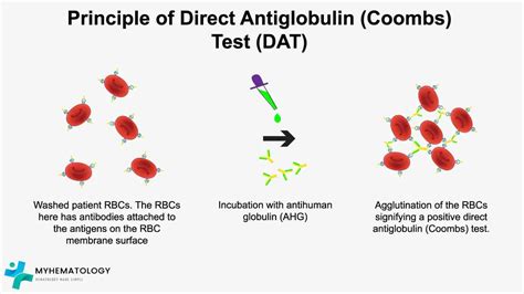 Direct Antiglobulin Coombs Test Dat Principle And Procedure