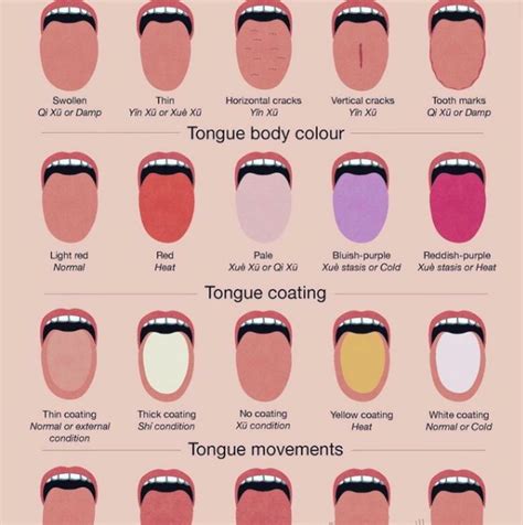 Pulse Diagnosis Acupuncture And Tongue