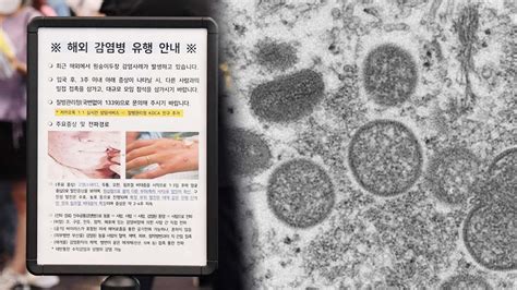 원숭이두창 2급 감염병 지정감염자 발생시 격리 연합뉴스tv Yonhapnewstv Youtube