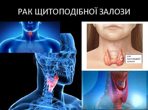 ЧОРНОБИЛЬ Це невелике місто розташоване на березі Київського