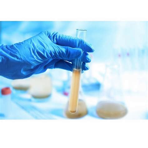 Preservative Testing Services In Ahmedabad Id 2854902499997