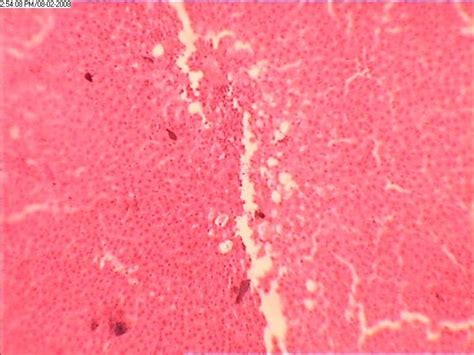 Sections Of Liver Tissues In Various Groups Download Scientific Diagram
