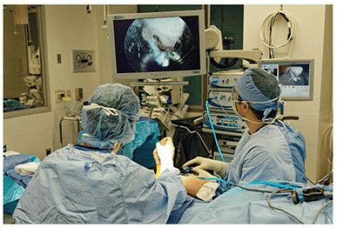 Endoscopic Plantar Fascia Release Gastrocnemius Recession And