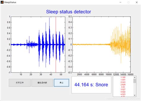 【脑电信号】基于matlab Hmm睡眠状态检测【含matlab源码 050期】sleep Analysis Matlab Csdn博客
