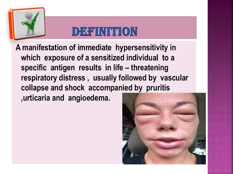 Anaphylactic Shock And Its Various Types Pdf Pdf First Aid Injuries
