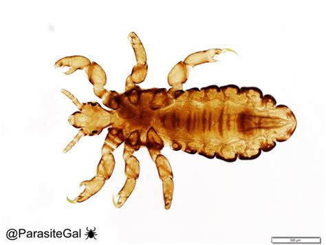 Pediculus Humanus Capitis Adult