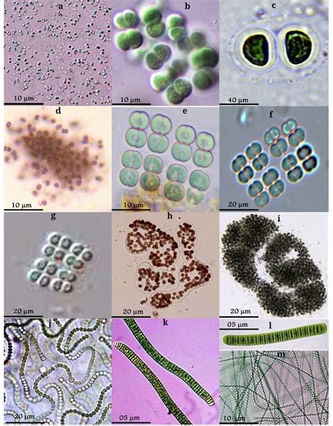 A Aphanocapsa Grevillea Bchroococcus Limneticus C Chroococcus