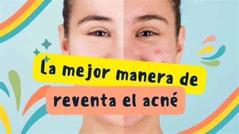 Cómo sacar barros en la cara en 5 minutos YouTube